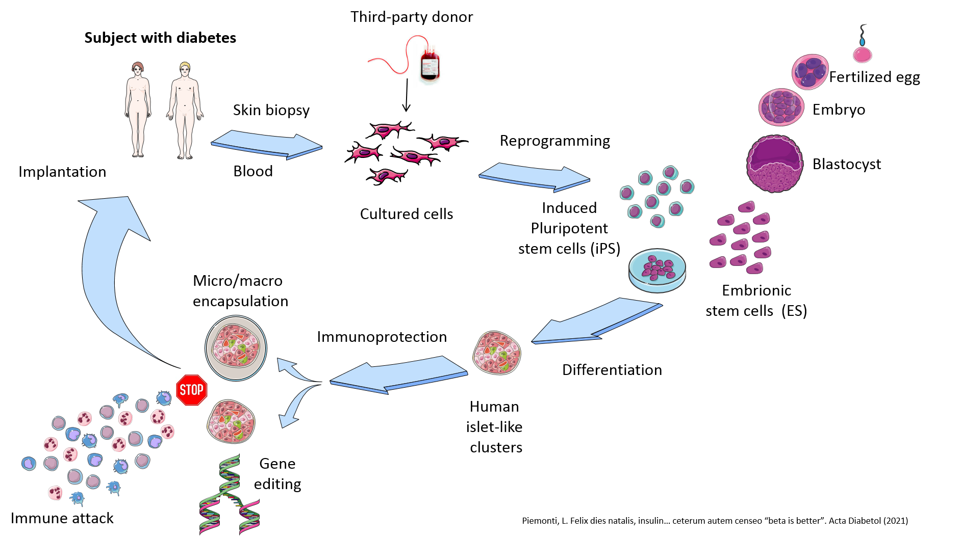 Cura del diabete di tipo 1: primi dati positivi dallo studio clinico con cellule producenti ...